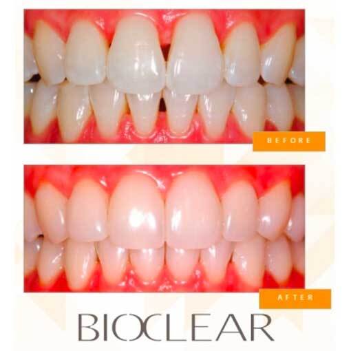 Our Services | Rosetown Dental